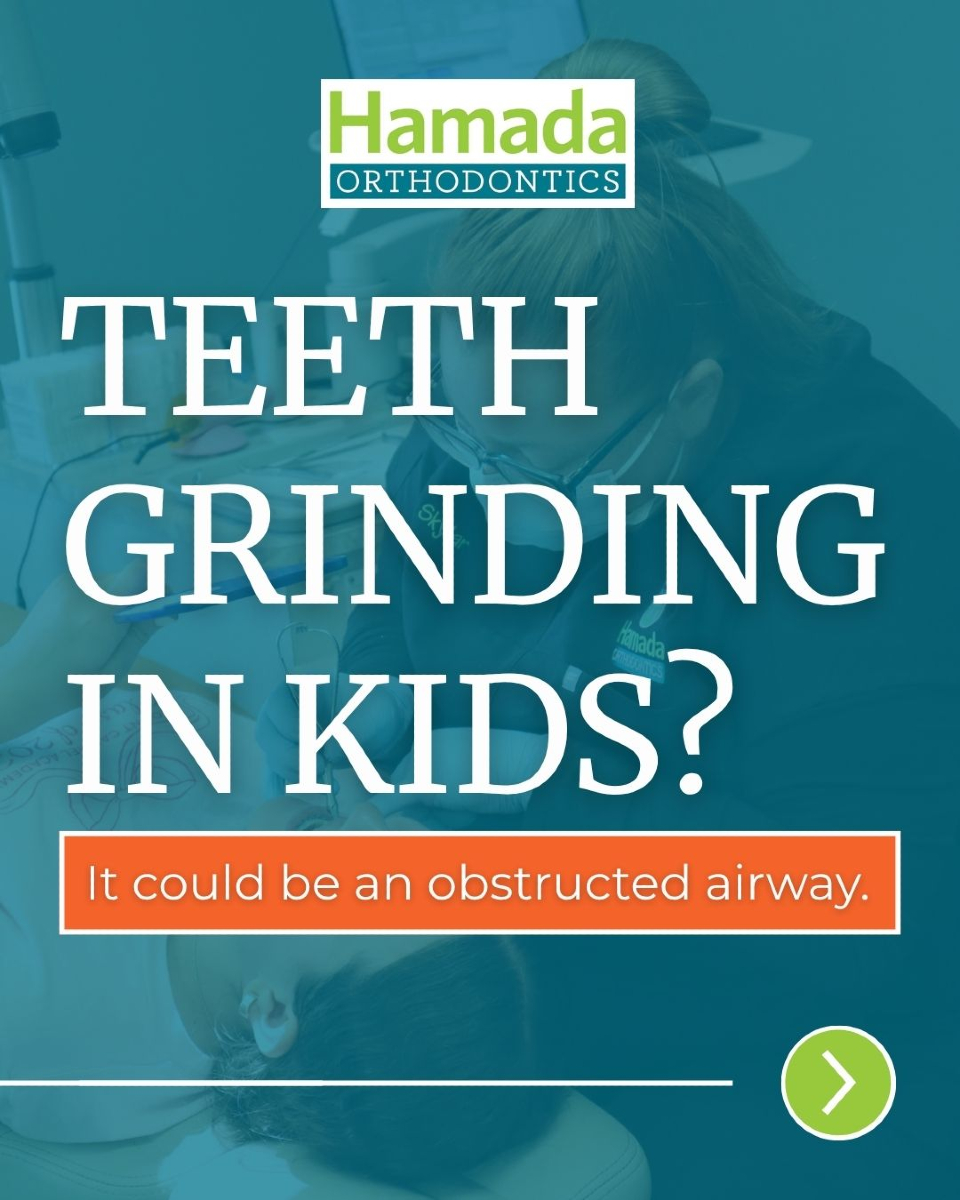 How to Stop Teeth Grinding in Metairie, LA